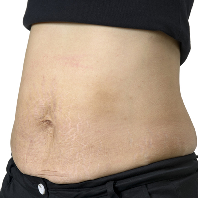 Sculpiflex #1 Body Sculptor