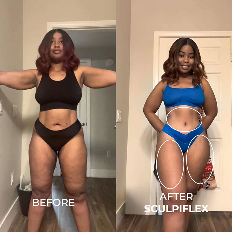 Sculpiflex Funnel Spanish