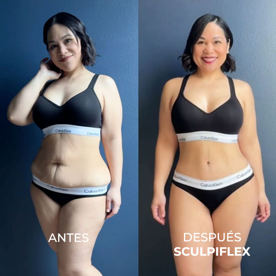 Sculpiflex Funnel Spanish